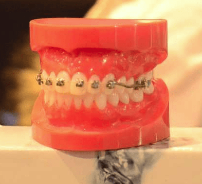 Medically Indicated Orthodontic Care: A Change in Concept | EODO